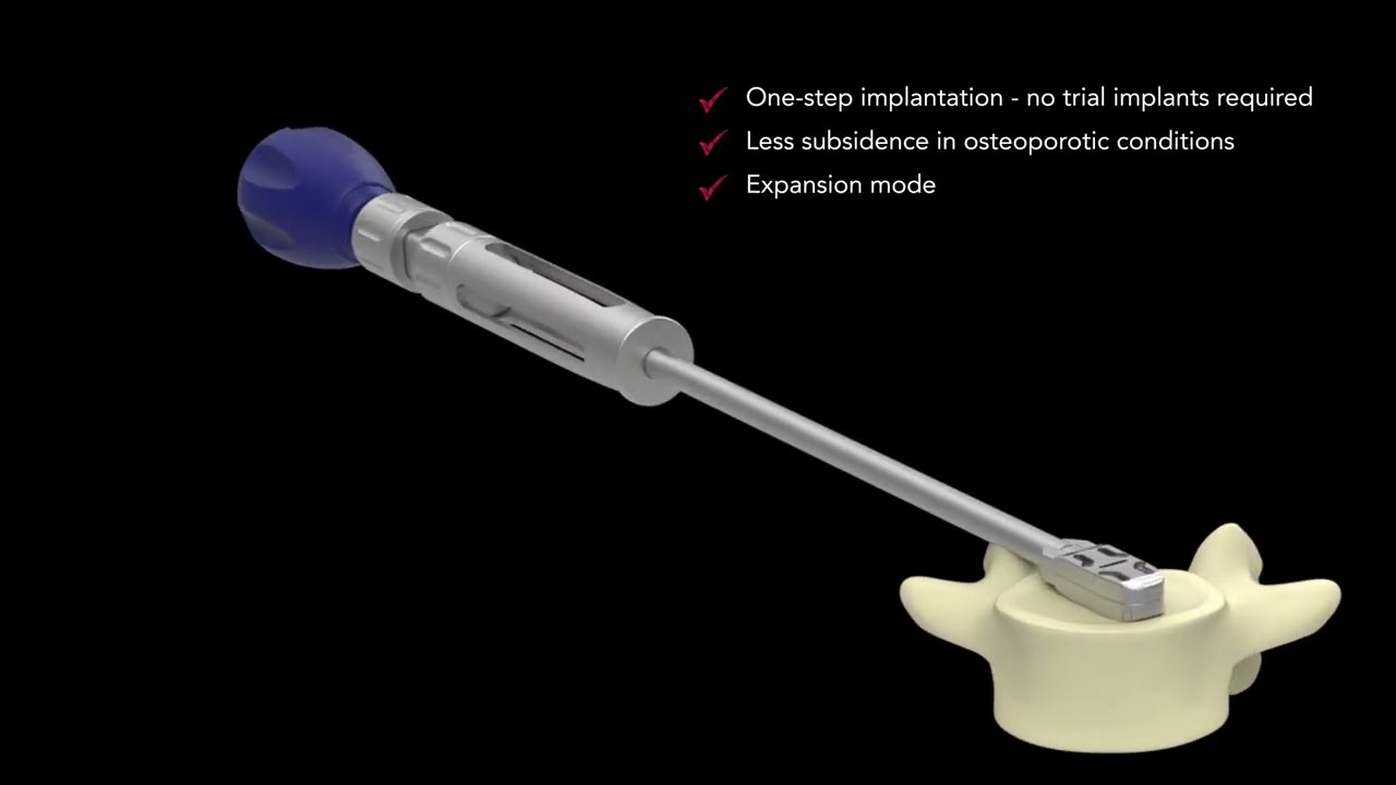 ELYON EXPANDABLE TITANIUM LUMBAR INTERBODY CAGE – Elyon videos